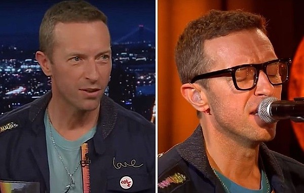 Chris Martin’s Hair Transplant: Are the Rumours True?