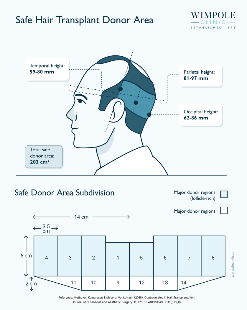 Hair Transplant Donor Area: What It Is and How to Care for It