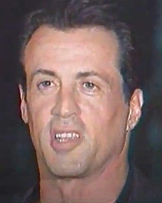 Sylvester Stallone’s Hair Transplant: Did It Really Happen?
