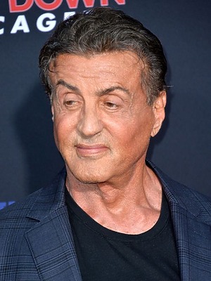 Sylvester Stallone’s Hair Transplant: Did It Really Happen?