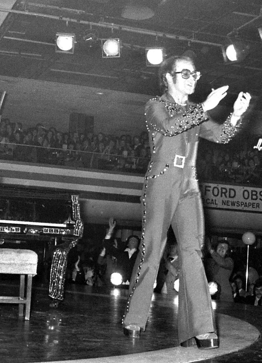 Elton John's Hair Transplant: Everything You Need to Know