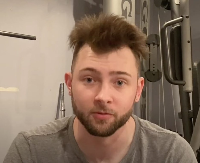 Finasteride Results: Timeline, Photos, Before & After