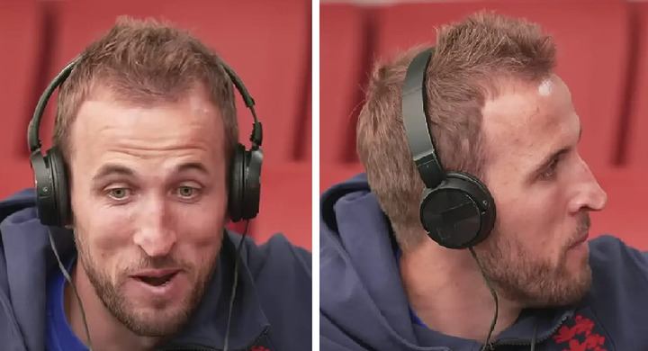 Harry Kane Hair Transplant: Everything You Need To Know