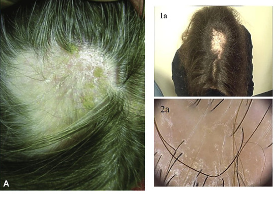 8 Common Scalp Problems: Photos, Causes, Treatments