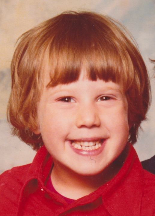 Matt Lucas Alopecia: Everything You Need To Know - Wimpole Clinic