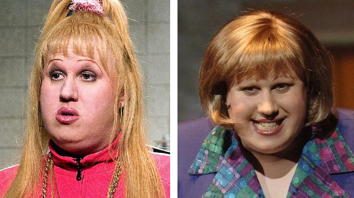 Matt Lucas Alopecia: Everything You Need To Know - Wimpole Clinic