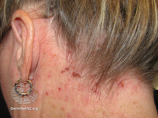 23 Causes Of An Itchy Scalp, According To The NHS