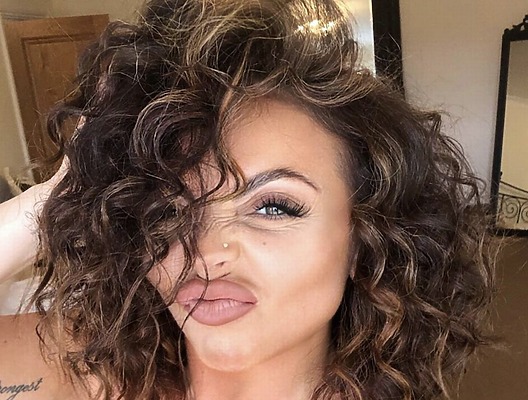 12 Celebrities With Alopecia & Hair Loss | Wimpole Clinic