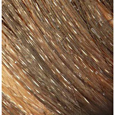 What is Trichoclasis – How is it Best Managed? | Wimpole Clinic