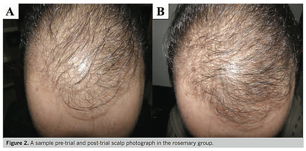 How Long Should You Leave Rosemary Oil In Your Hair?
