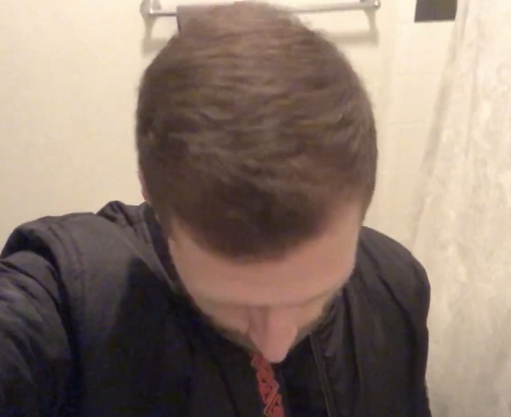 Finasteride Results: Timeline, Photos, Before & After