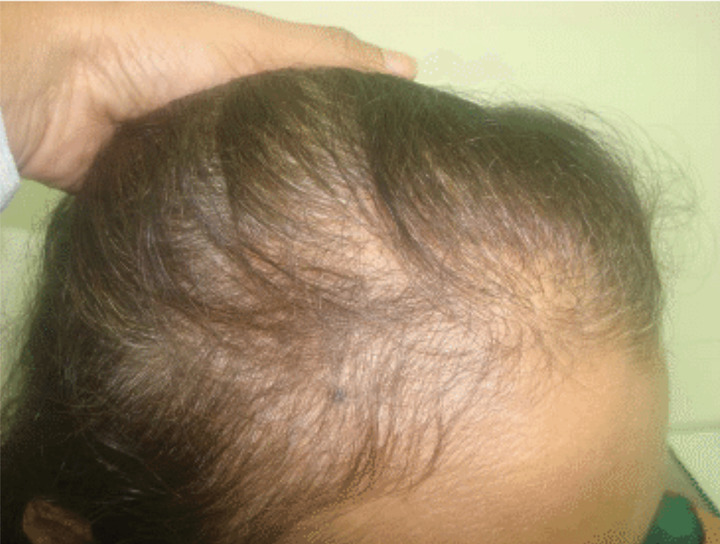 22 Ways To Treat & Repair Damaged Hair At Home - Wimpole Clinic