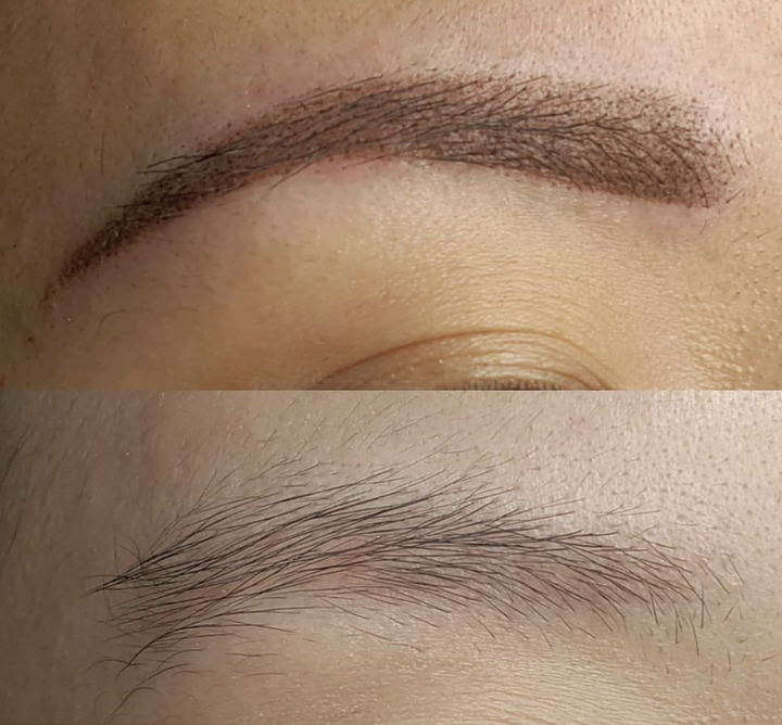 Eyebrow Tattooing: Pros, Cons, Costs, Alternatives - Wimpole Clinic