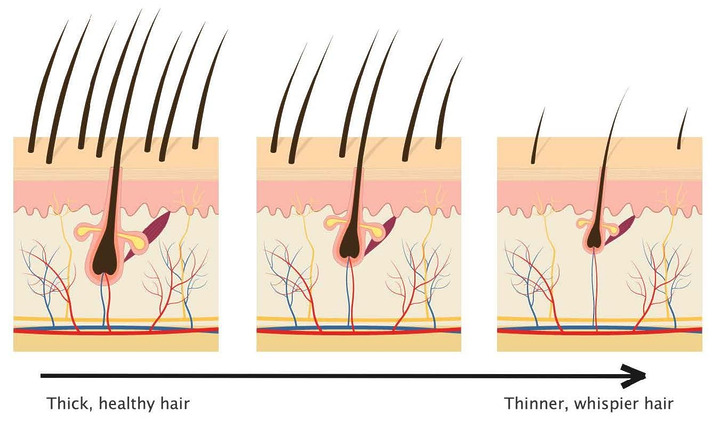 10 Reasons Your Hair Feels Thinner and How to Treat It
