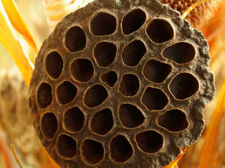 29 Fue Hair Transplant Trypophobia BalenWateen