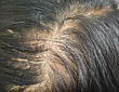 Normal Hair Parting Width vs Thinning: Causes and Treatments